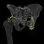 INOV8 Surgical | Outpatient Total Joint Center in Houston, TX